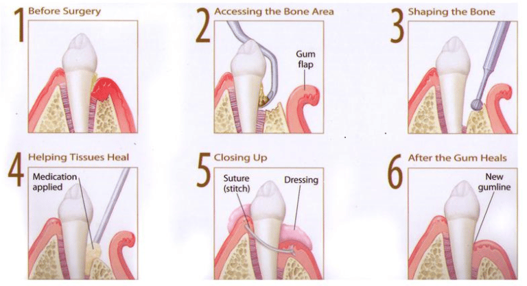 Periodontics - Ashbourne Medical